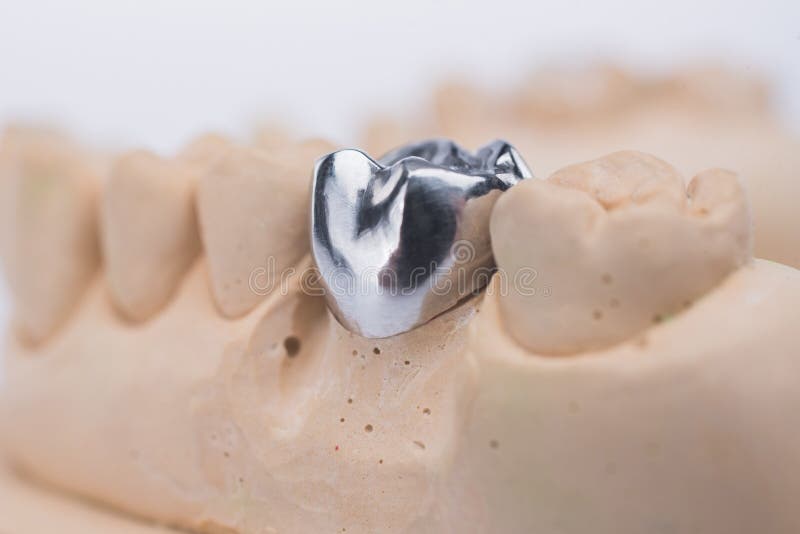 New Dentures with One Metal Tooth on a Light Background Stock Image ...