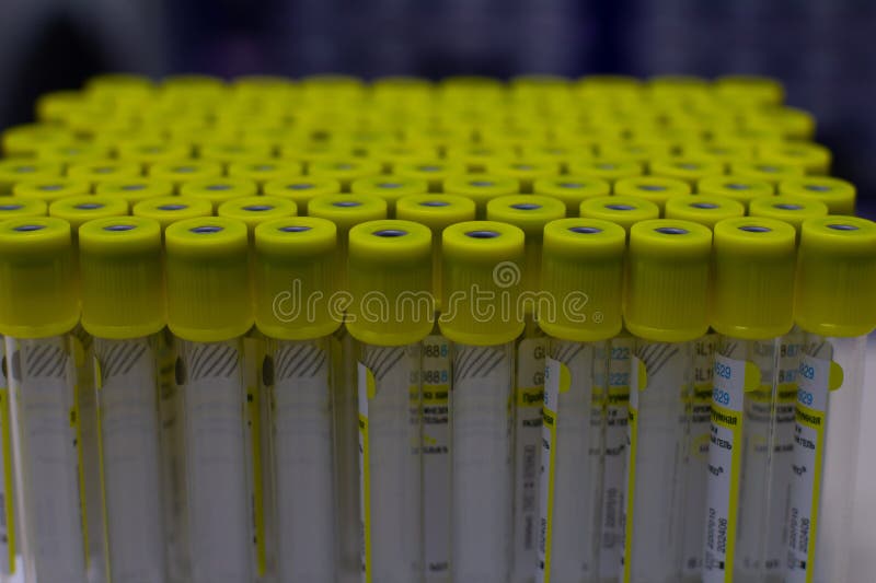 A New Pack of Test Tubes is on the Table in the Laboratory. the Tubes ...