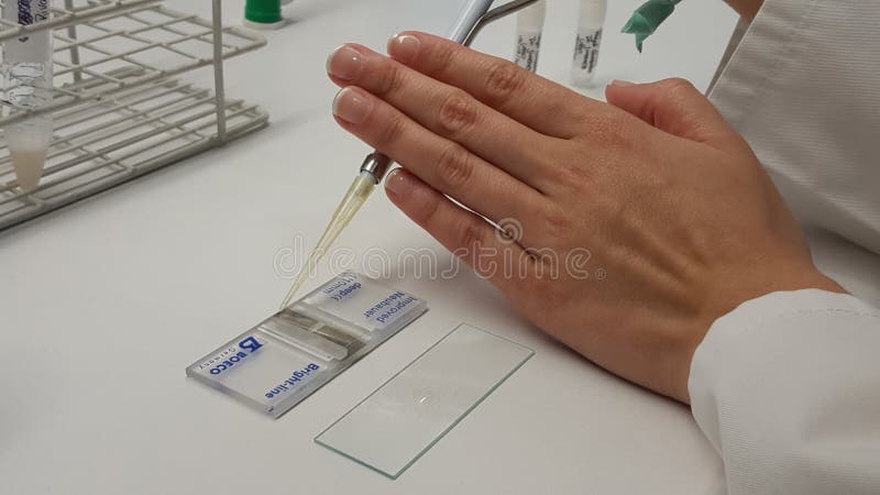 Newbauer chamber editorial stock image. Image of microscopy - 71468109