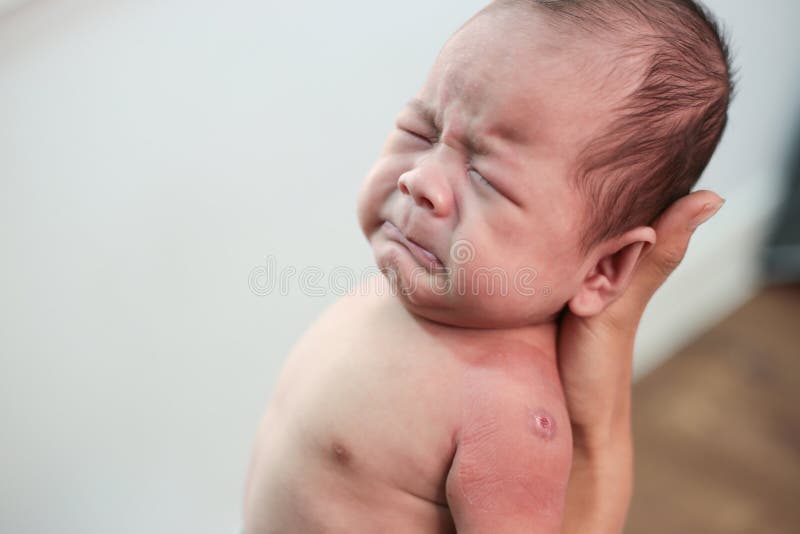 Newborn Baby with Red Spots Due To Injection Stock Image - Image of ...