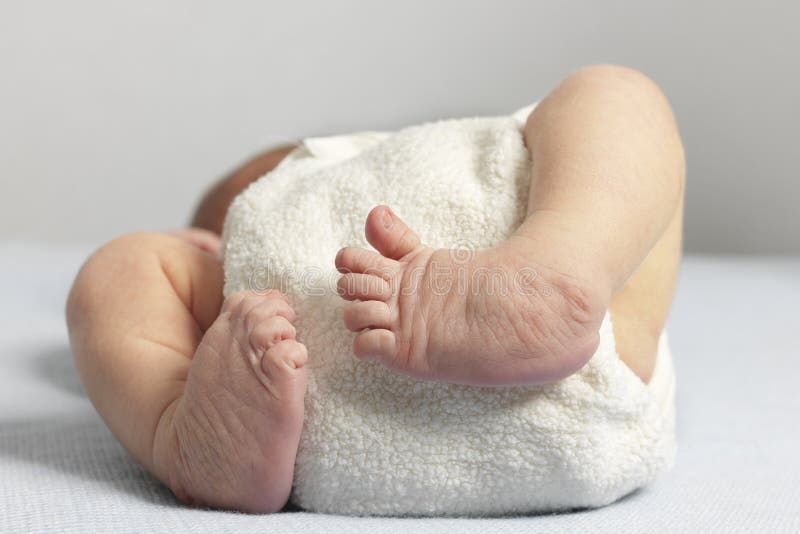 Newborn with Bilateral Club Foot Stock Photo - Image of care ...