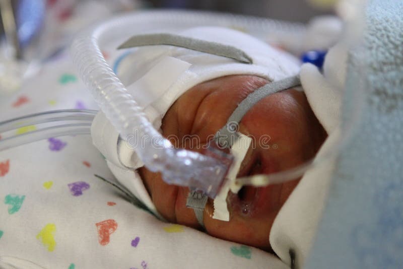 Newborn within Incubation Apparatus with Oxygen Pipe Stock Image ...