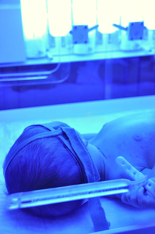 Newborn jaundice stock photo. Image of human, lamps, infant - 24826768