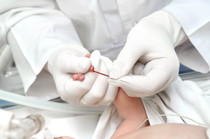 Newly-born Child Blood Sampling Stock Photo - Image of exam, born: 12697856