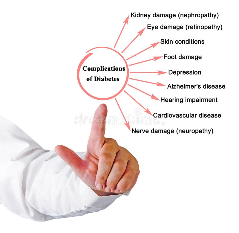 Nine Complications of Diabetes Stock Image - Image of pointing ...
