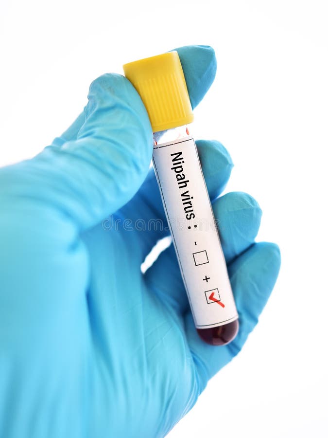 Nipah Virus Positive Blood Sample Stock Photo - Image of fever, death ...