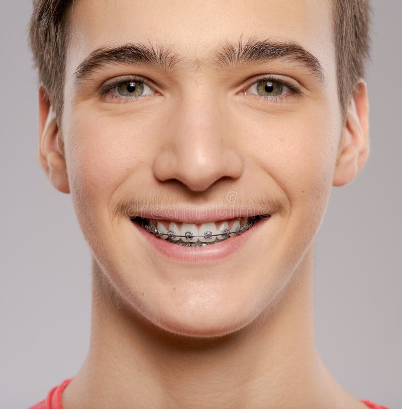 Niño Adolescente Sonriente Con Cordones En Los Dientes Retrato De