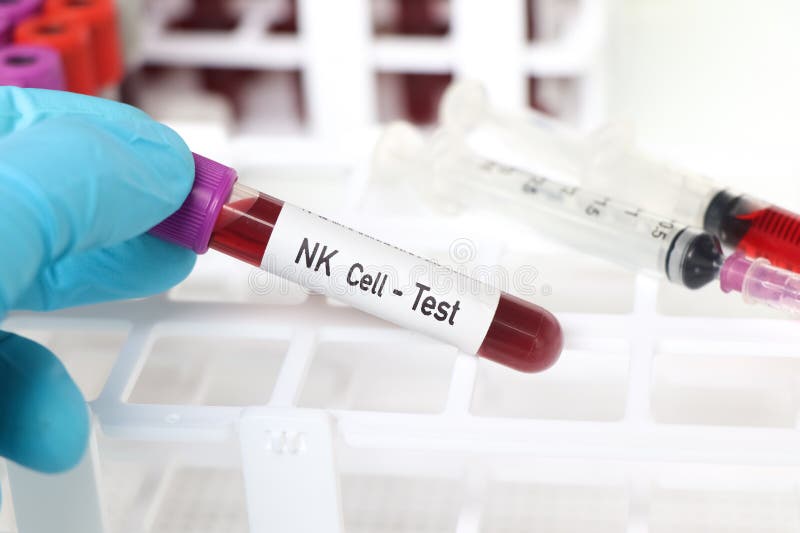NK Cell Test, Blood Sample To Analyze in the Laboratory Stock Image ...