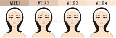 No acne stock illustration. Illustration of cosmetician - 6105588