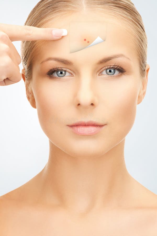 No more acne stock image. Image of cleanse, human, living - 38283125