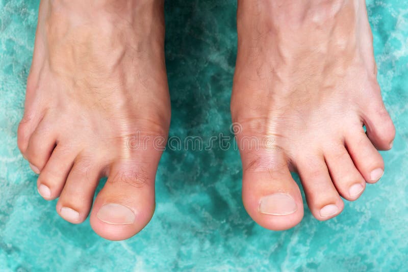 No skin problems stock photo. Image of human, home, care - 60418548