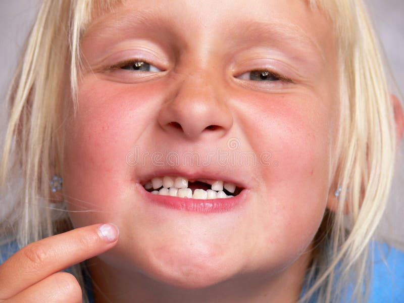No Tooth Picture. Image: 2952188