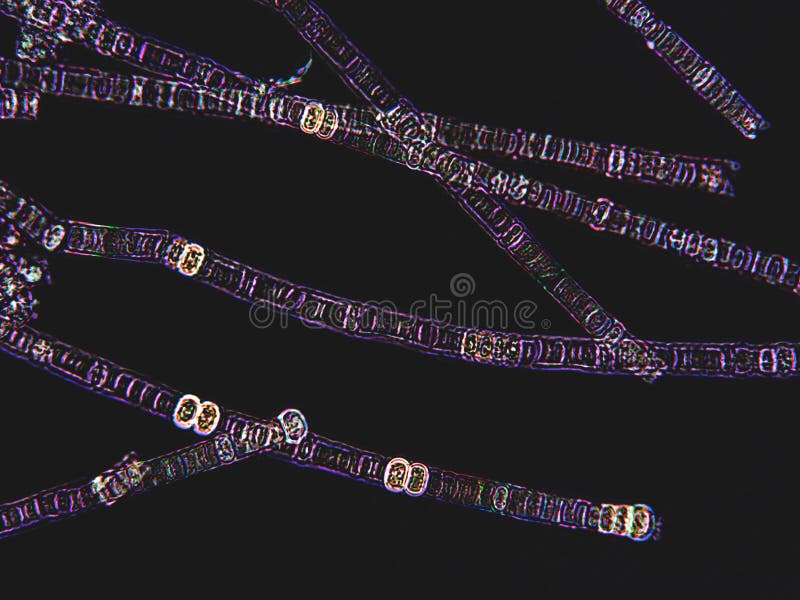 Nodularia Sp. Toxic Algae Under Microscopic View X40, Dark Background ...