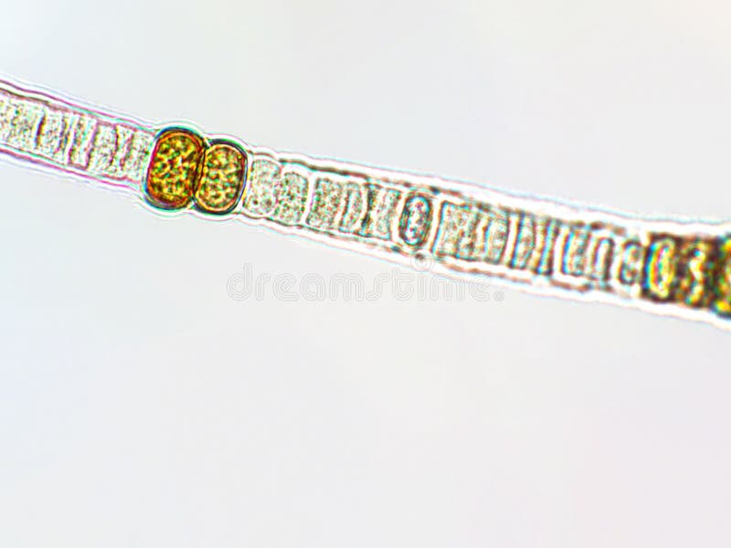 Nodularia Sp. Toxic Algae Under Microscopic View, Nitrogen-fixing ...