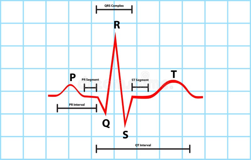Ventricular Depolarization
