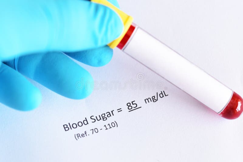 Normal Blood Sugar Test Result Stock Photo - Image of hyperglycemia ...