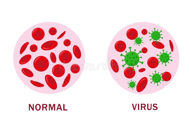 Normal Blood and Blood with Virus Stock Vector - Illustration of icon ...