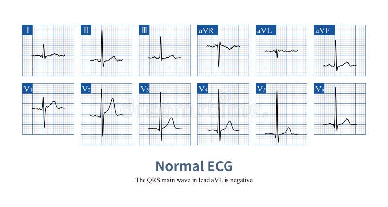 Isoelectric Point Rtio2 Stock Photos - Free & Royalty-Free Stock Photos ...