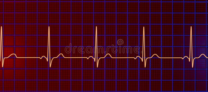 A Normal Electrocardiogram, 3D Illustration Displaying the Electrical ...