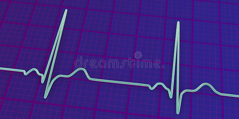 A Normal Electrocardiogram, 3D Illustration Displaying the Electrical ...