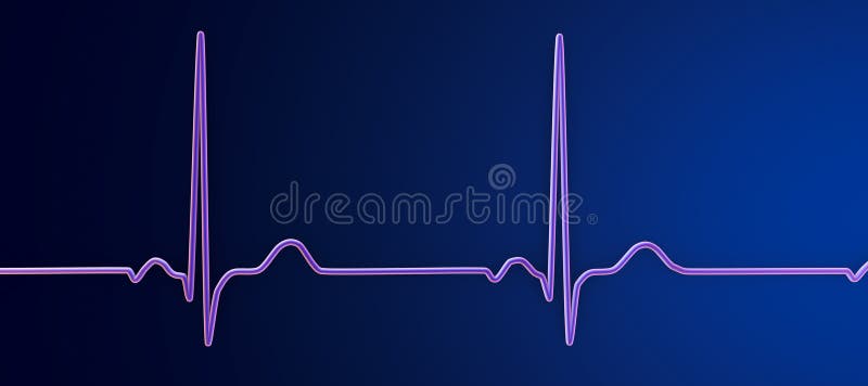 A Normal Electrocardiogram, 3D Illustration Displaying the Electrical ...
