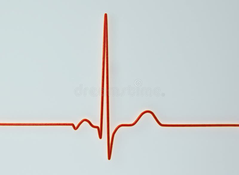A Normal Electrocardiogram, 3D Illustration Stock Illustration ...