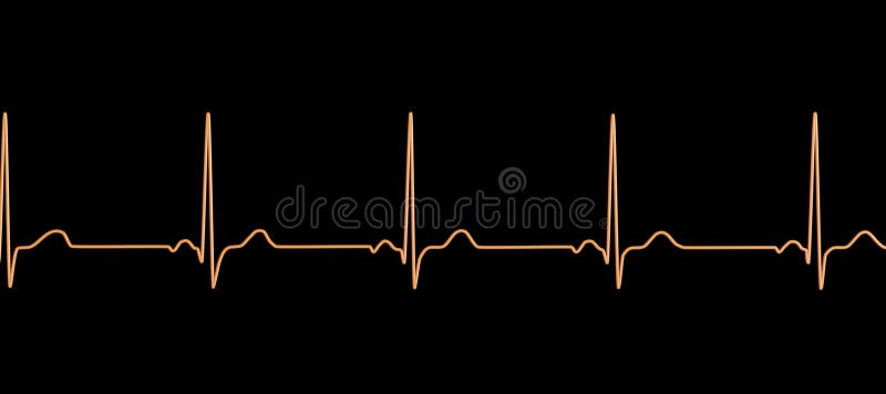 A Normal Electrocardiogram, 3D Illustration Displaying the Electrical ...