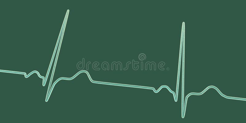 A Normal Electrocardiogram, 3D Illustration Stock Illustration ...