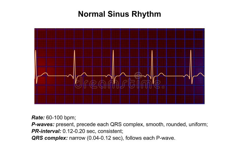 A Normal Electrocardiogram, 3D Illustration Stock Illustration ...
