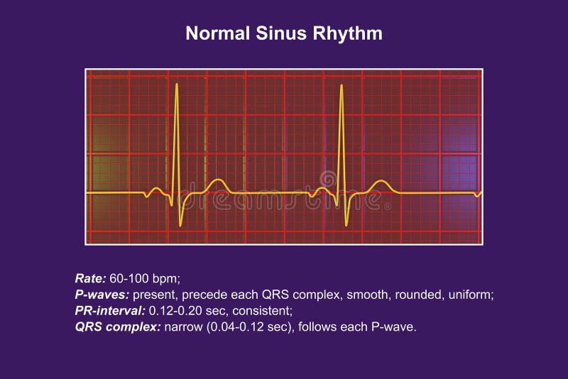 A Normal Electrocardiogram, 3D Illustration Stock Illustration ...