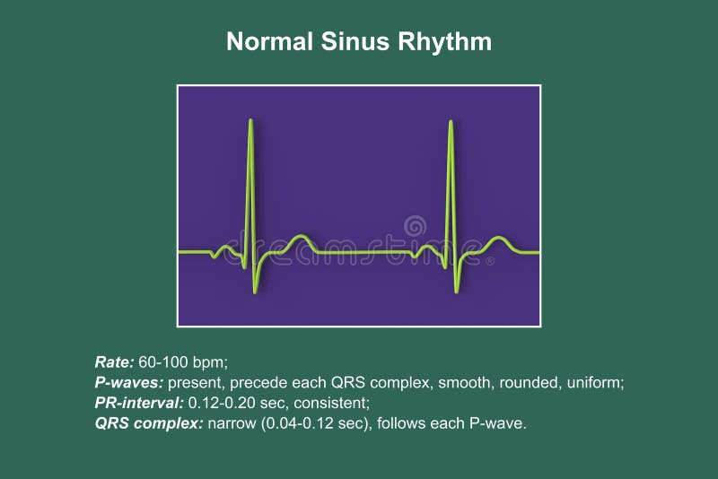 A Normal Electrocardiogram, 3D Illustration Stock Illustration ...