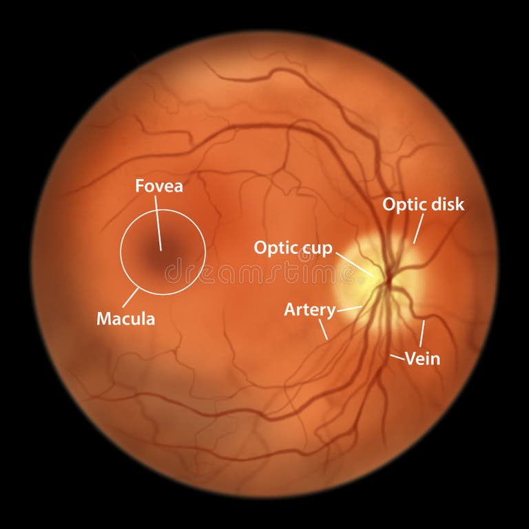 Optic Disk Stock Illustrations – 161 Optic Disk Stock Illustrations ... Optic Disk Stock Illustrations – 161 Optic Disk Stock Illustrations ...