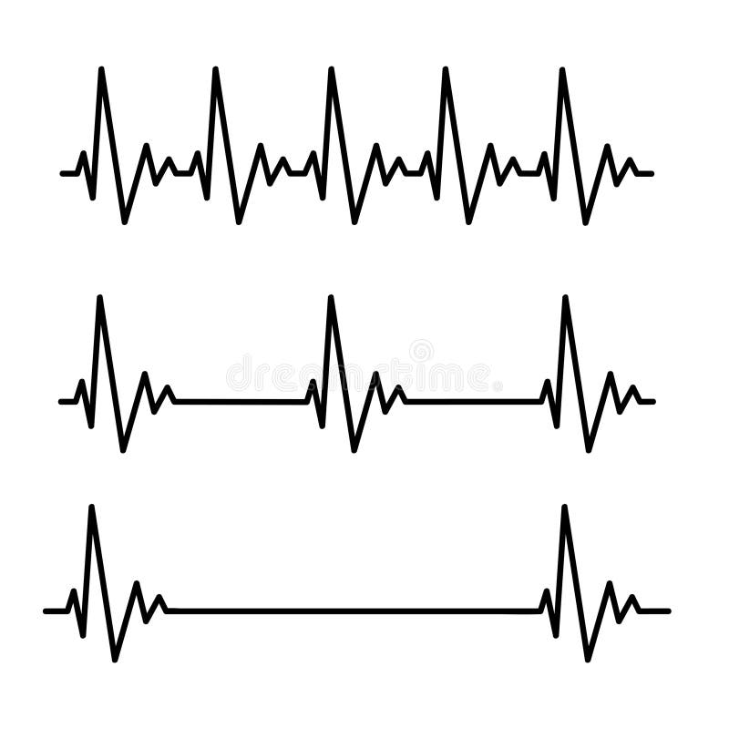 Normal Heart Rate Linear Illustration on White Background Stock ...