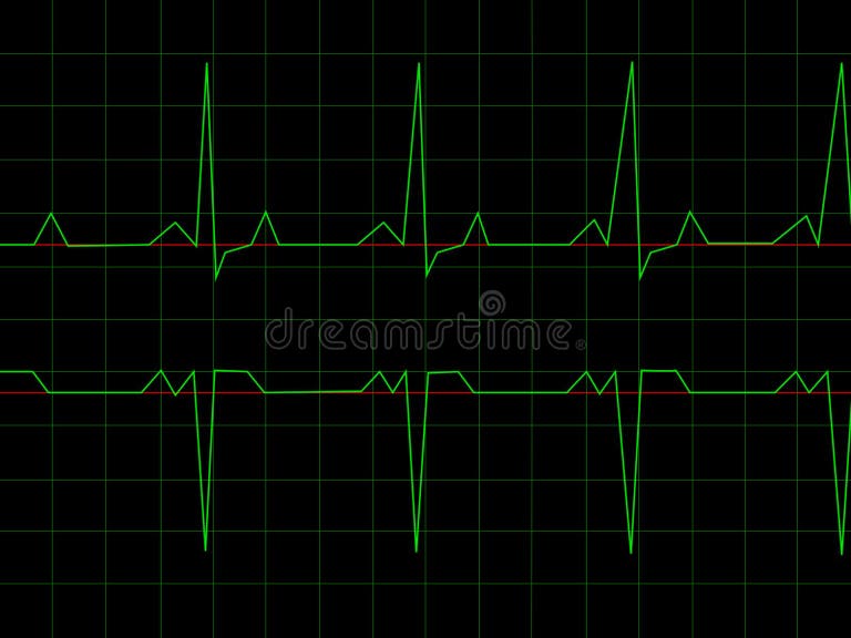 Electrical Rhythm Stock Illustrations – 1,540 Electrical Rhythm Stock ...