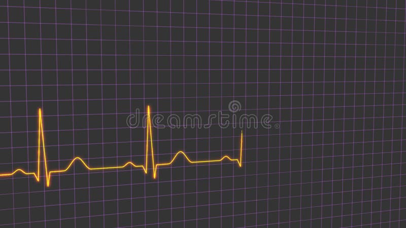ECG, Electrocardiogram of a Healthy Person, Normal Heart Rhythm. Looped ...