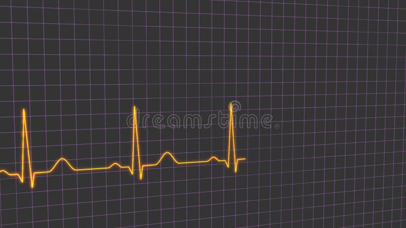 Normal Electrocardiogram Stock Illustrations – 617 Normal ...