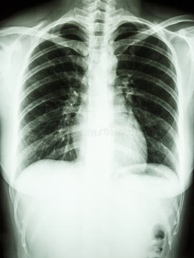 Normal human chest stock image. Image of anatomy, healthcare - 37565301