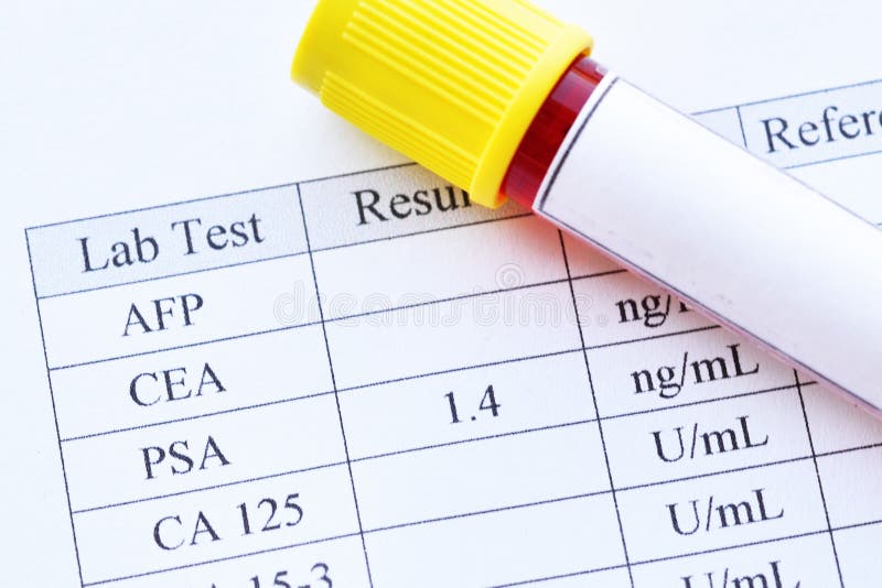 Normal PSA test result stock photo. Image of male, hospital - 122928374