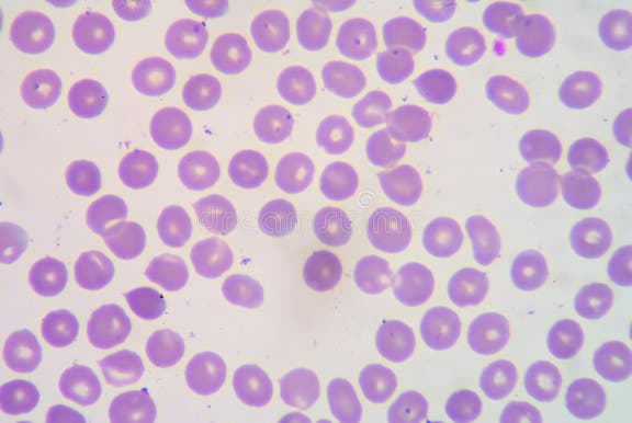 Normal rbc stock image. Image of killer, immune, organism - 51698021