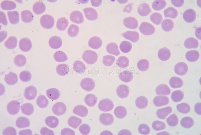 502 Peripheral Blood Smear Stock Photos - Free & Royalty-Free Stock ...