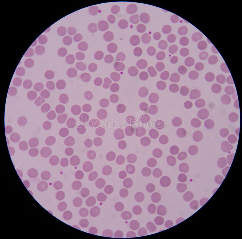 Normal red blood cells stock image. Image of lymph, lymphocyte - 68459891