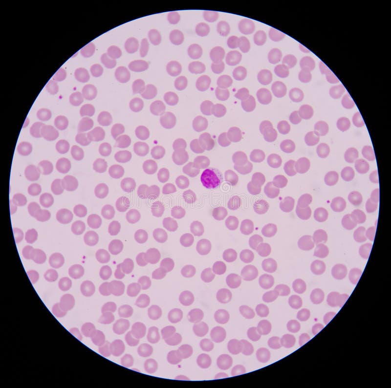 Normal red blood cells stock photo. Image of asthma, medicine - 68459908