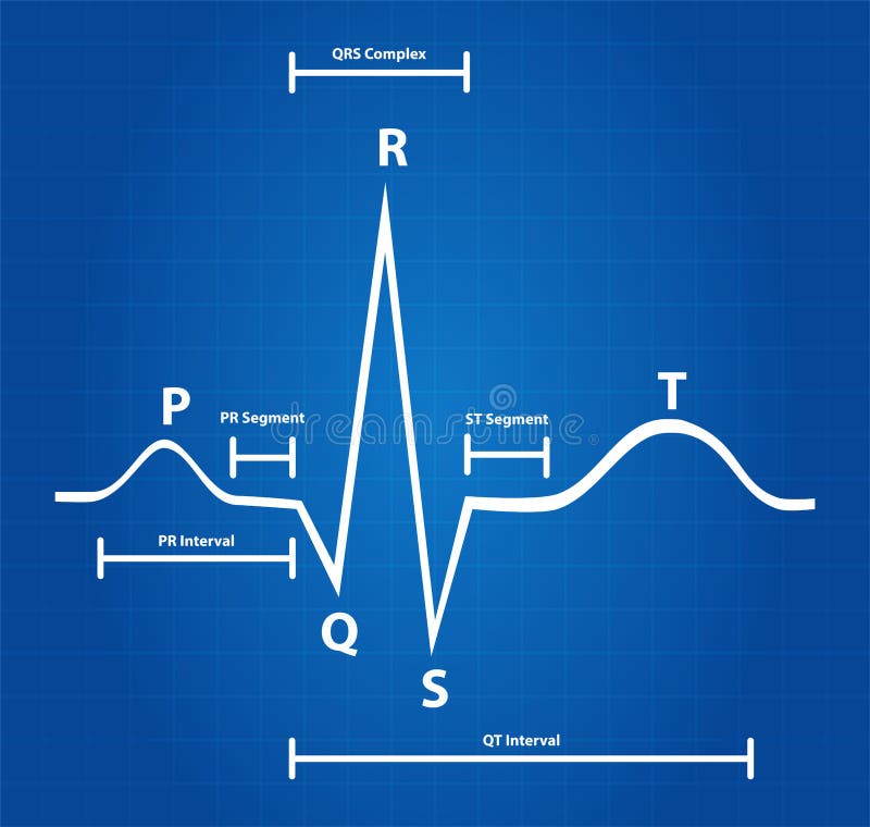 Normalt elektrokardiogram vektor illustrationer. Illustration av ...