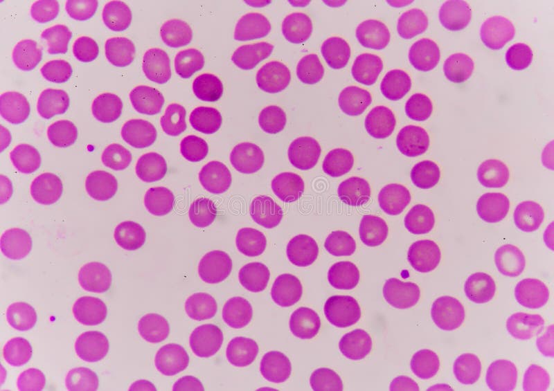 Normochromic Normacytic Red Blood Cells Stock Photo - Image of biology ...