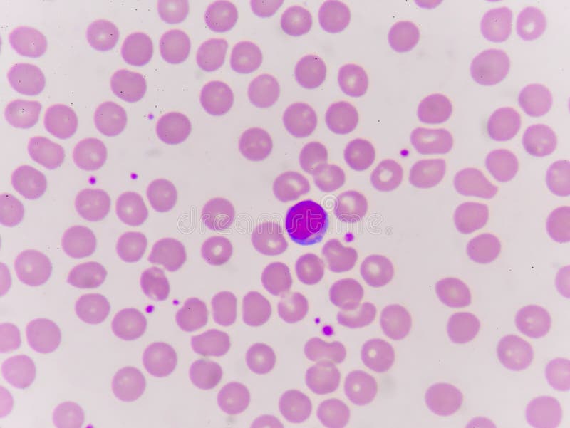 Normochromic Normacytic Red Blood Cells Stock Photo - Image of body ...