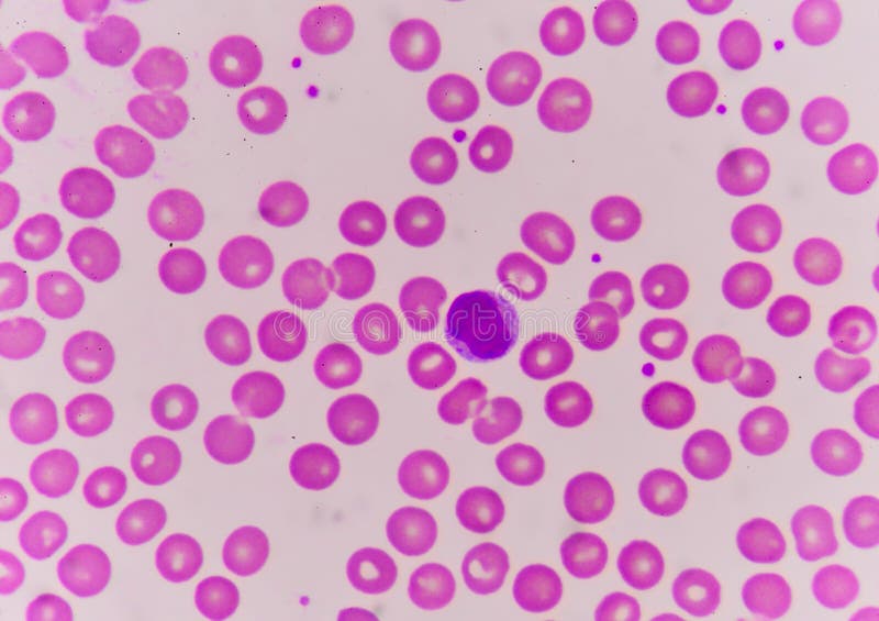 Red blood cells stock image. Image of close, medicine - 14687741