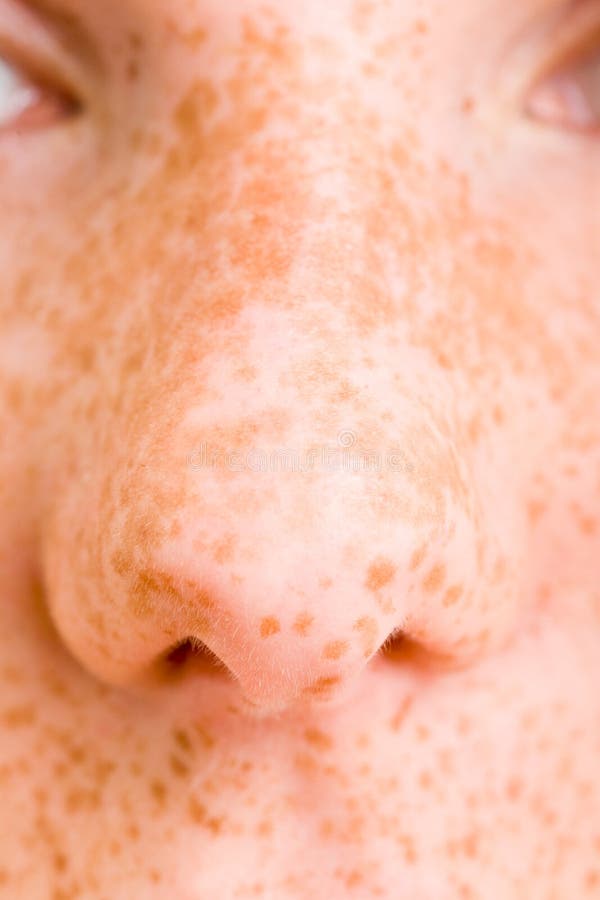 Nose stock photo. Image of perception, individuality - 10390480