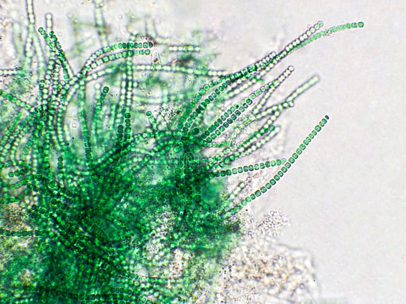 Nostoc Sp. Algae Under Microscopic View, Cyanobacteria, Providing ...