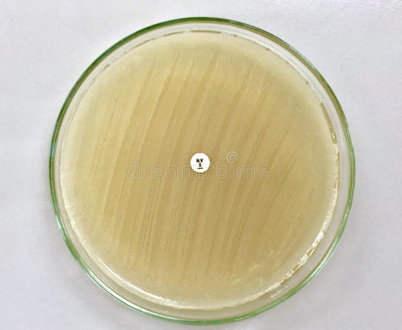 Novobiocin test stock image. Image of antimicrobial - 110190607