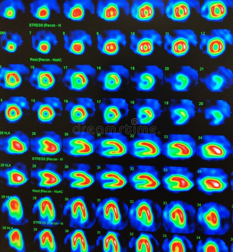 Check If Its 100 Stock Photos - Free & Royalty-Free Stock Photos from ...